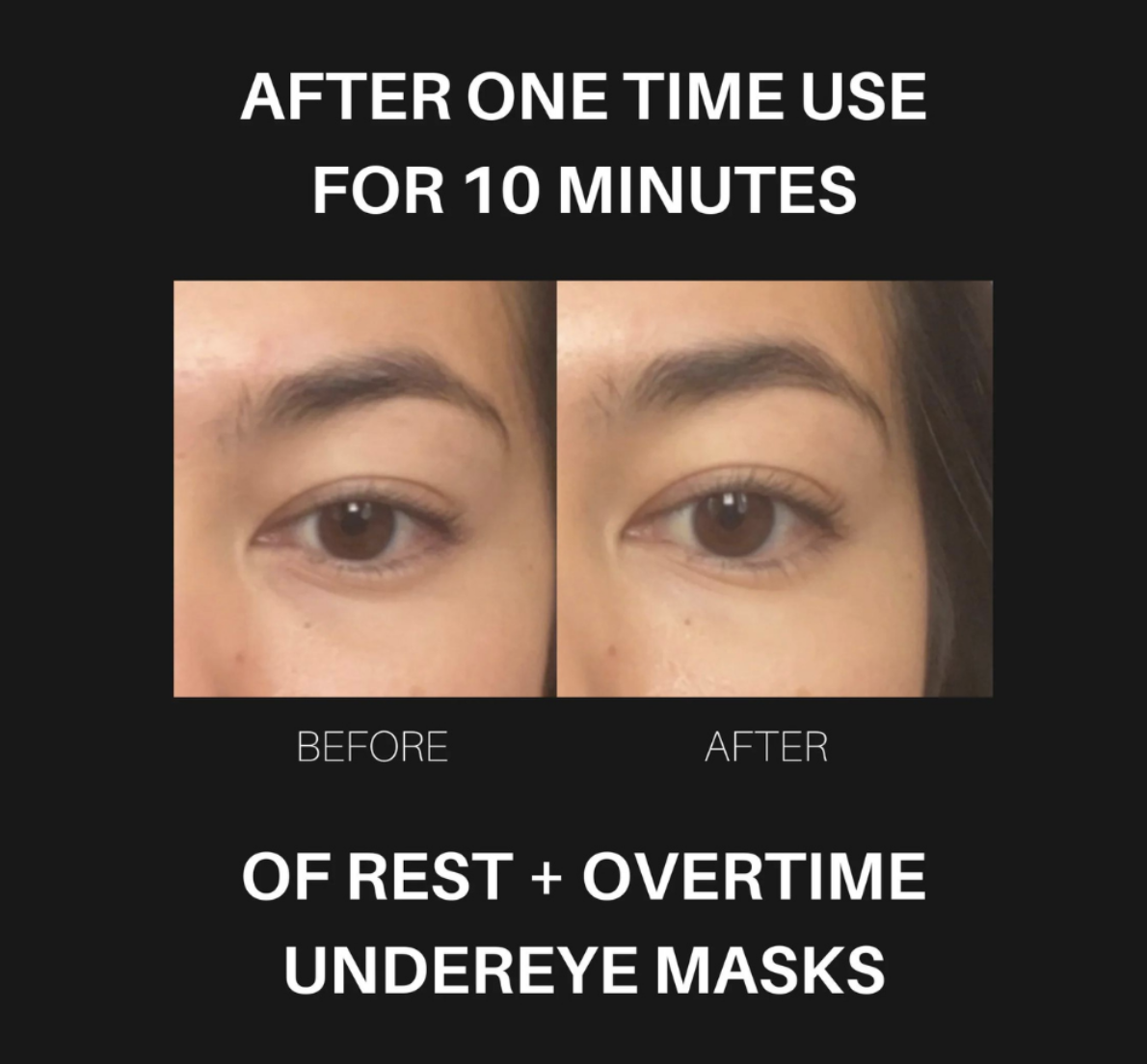 This before + after is amazing | 4AM SKIN